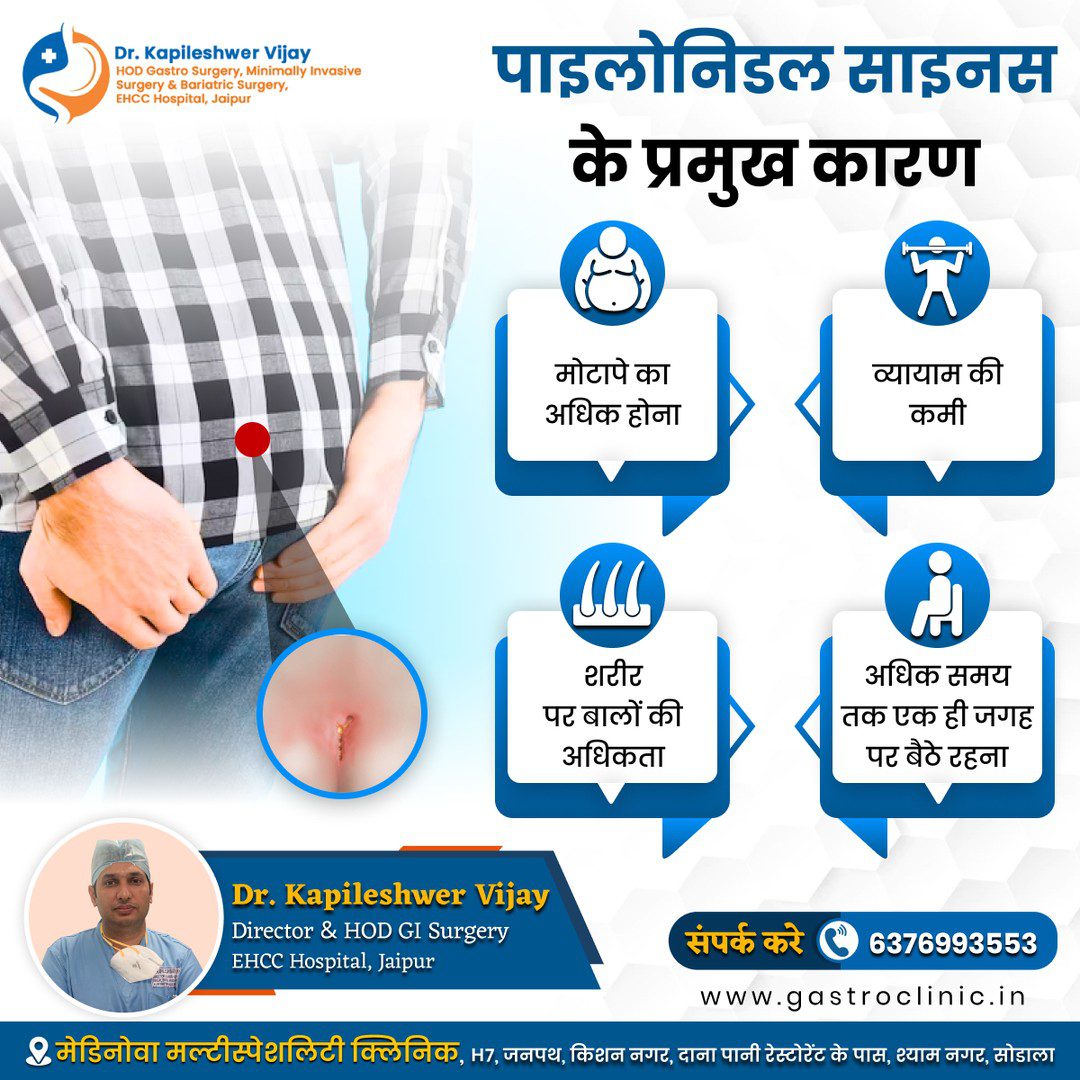 Pilonidal Sinus Causes Dr Kapileshwer Vijay Gastro Clinic