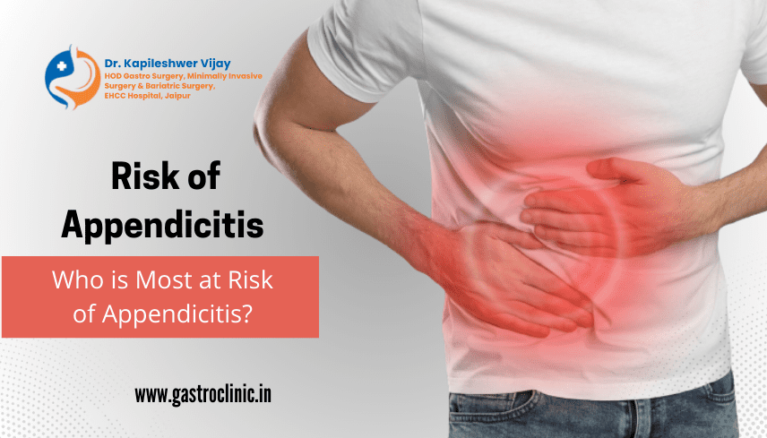 Who is Most at Risk of Appendicitis? | Gastro Clinic
