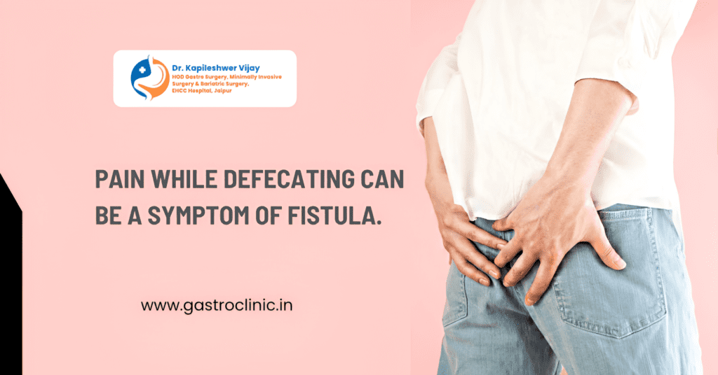 Symptom of Fistula: Understanding the Pain While Defecating