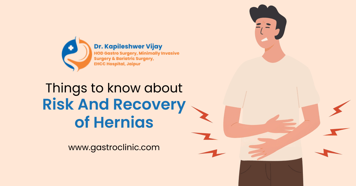 What To Eat And What To Foods Avoid In Appendicitis? - Gastro