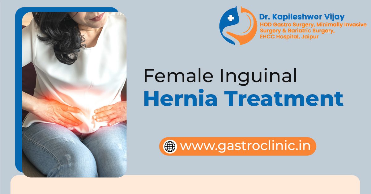 Female Inguinal Hernia Treatment Gastro