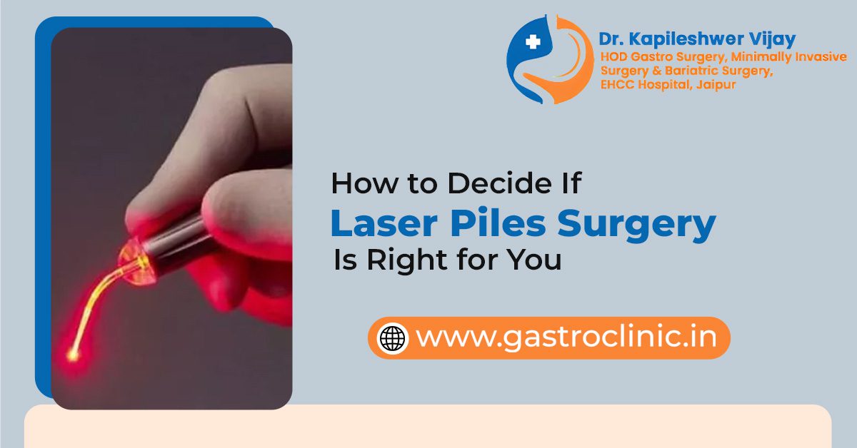 Laser Piles Surgery in Jaipur | Safe & Effective Treatment